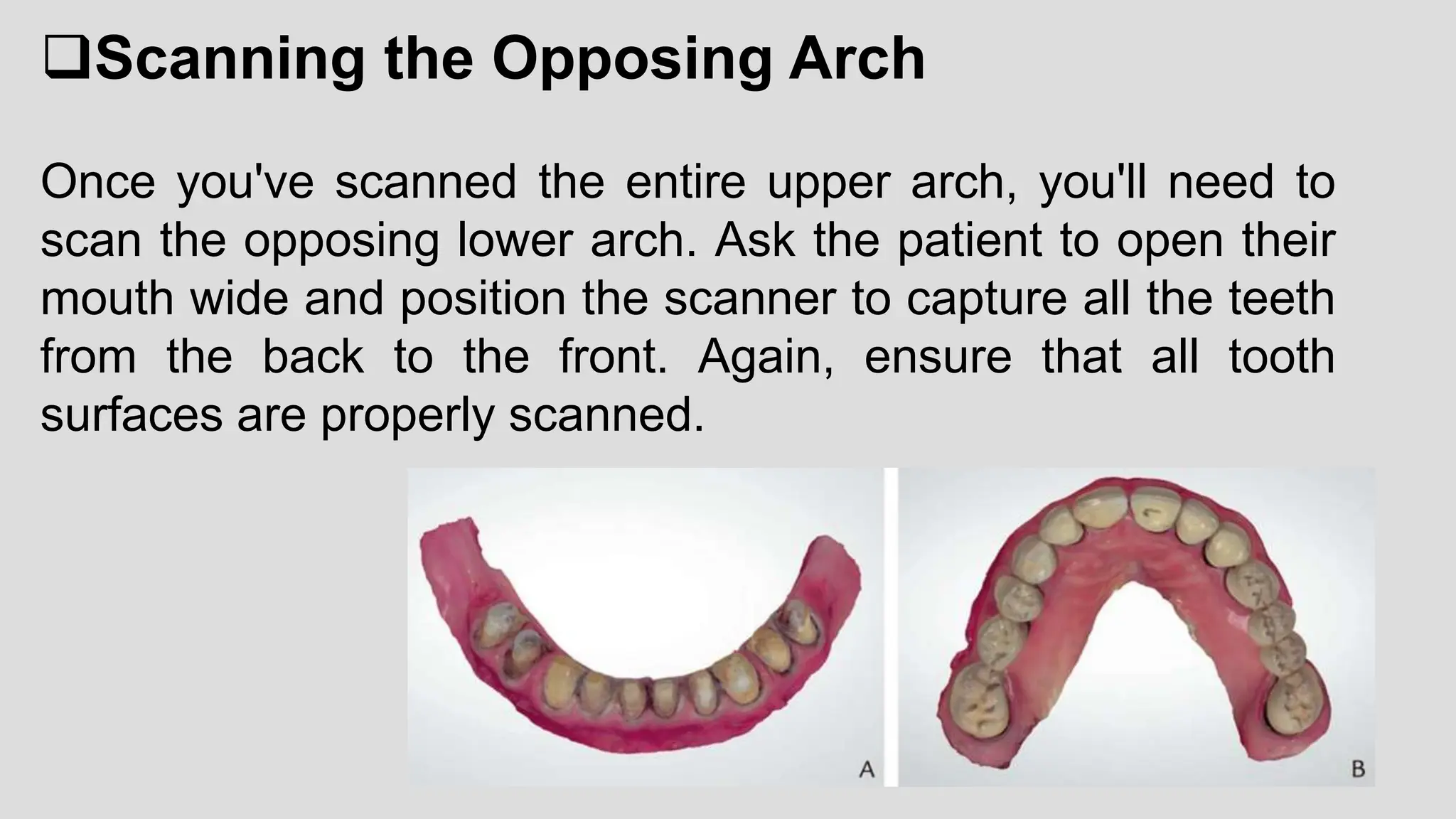 Applications Of Intra- Oral Scanners( IOS) In Crown And Bridge.pptx