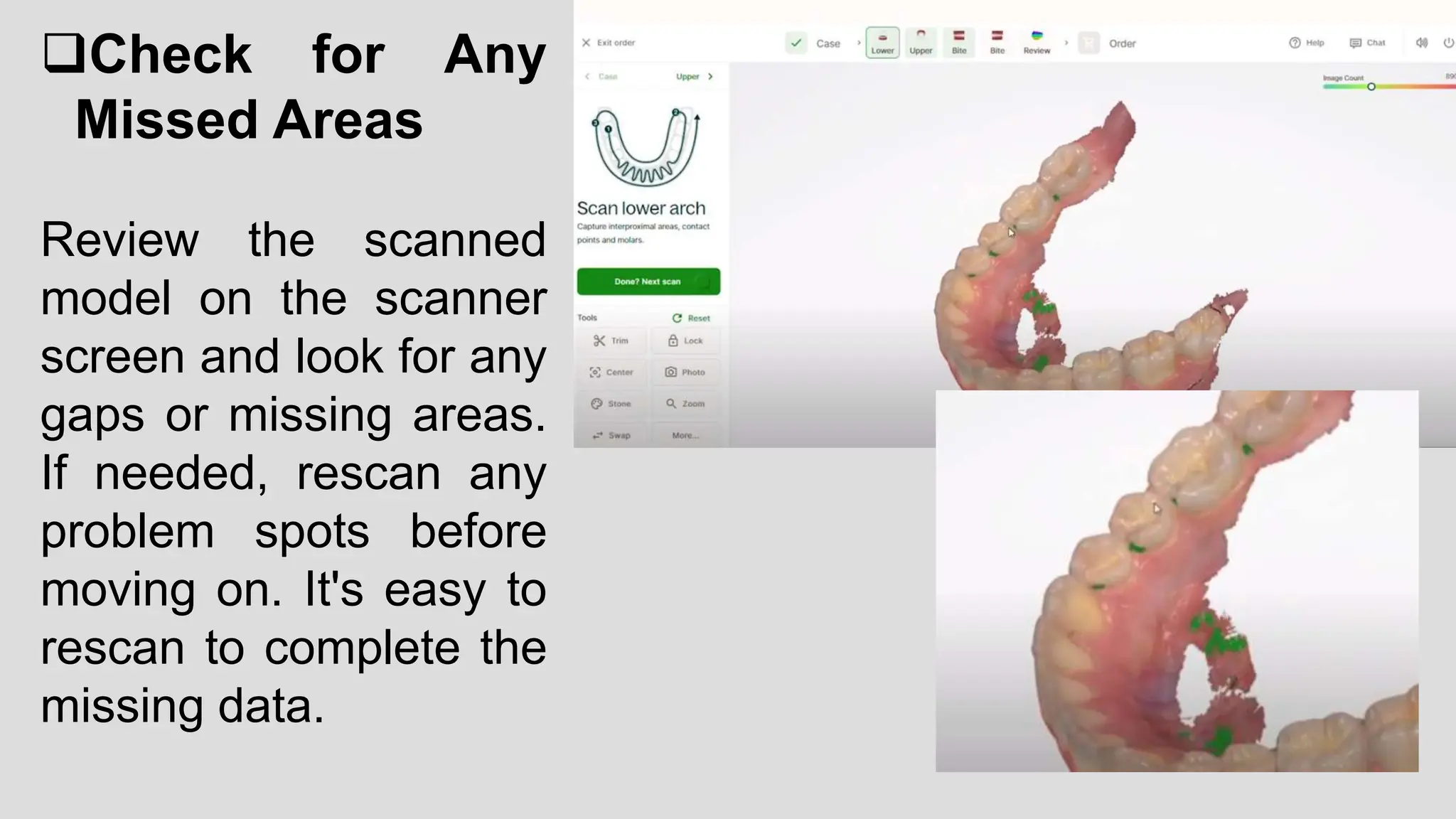Applications Of Intra- Oral Scanners( IOS) In Crown And Bridge.pptx