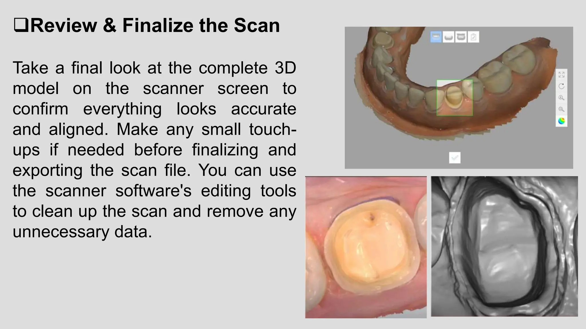 Applications Of Intra- Oral Scanners( IOS) In Crown And Bridge.pptx