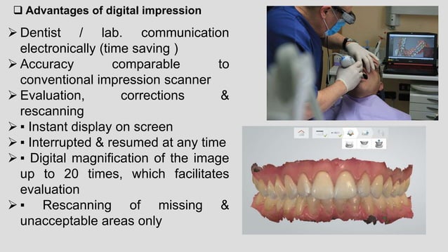 Applications Of Intra- Oral Scanners( IOS) In Crown And Bridge.pptx | 3 ...