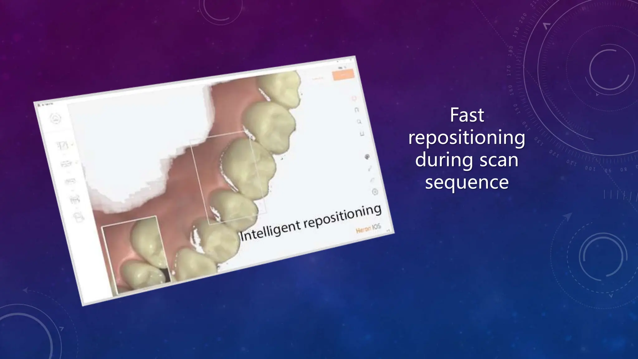Presentation on Basics of Intra Oral Scanner | PPTX