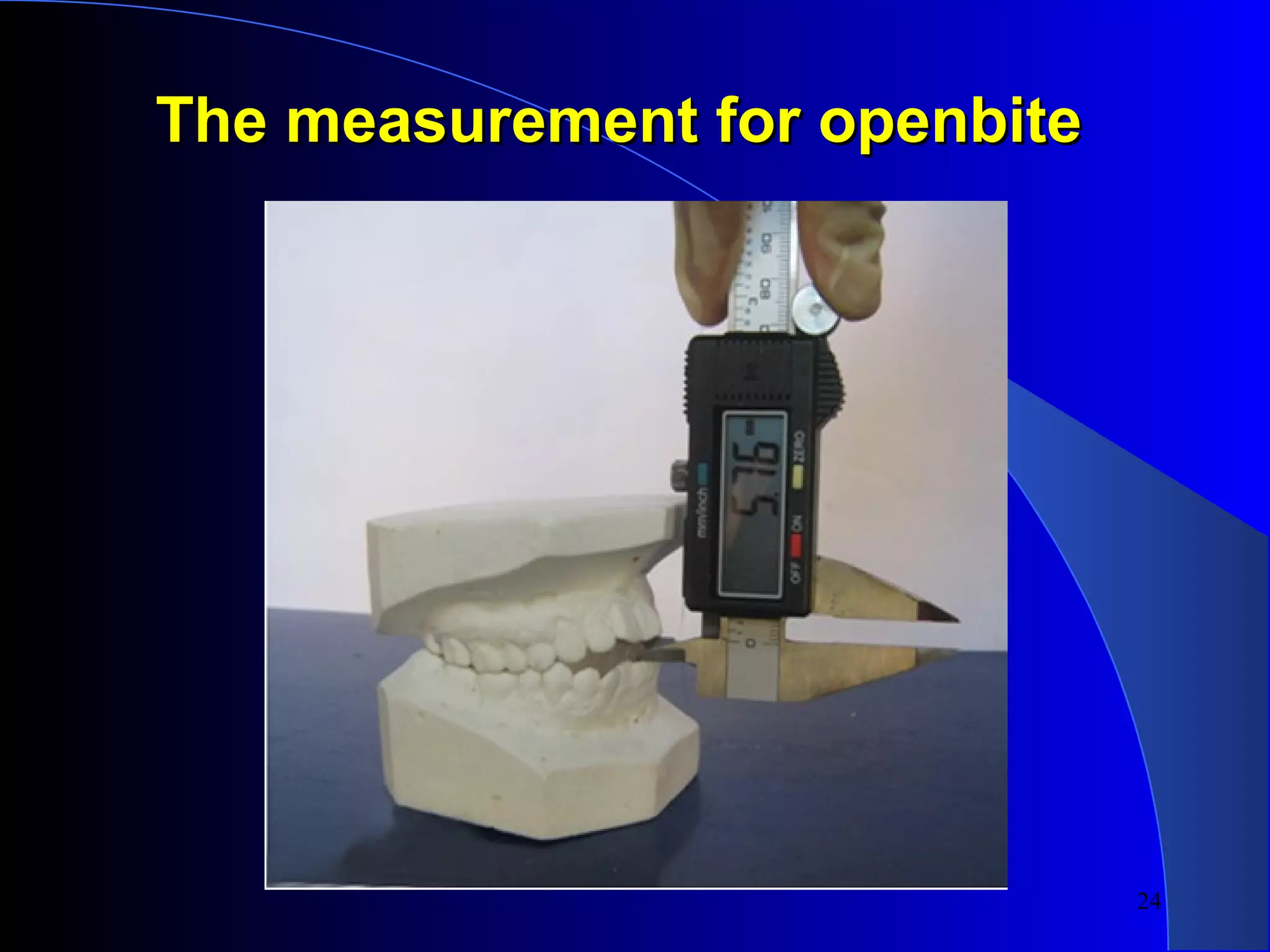 Index of Orthodontic Treatment Need (IOTN) | PPT