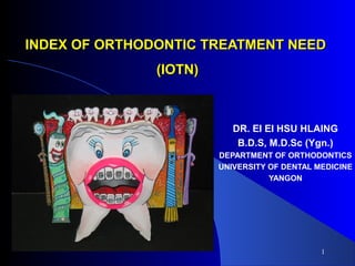Index of Orthodontic Treatment Need (IOTN) | PPT