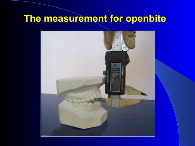 Index of Orthodontic Treatment Need (IOTN) | PPT | Dental Health ...