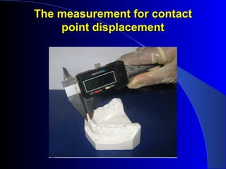 Index of Orthodontic Treatment Need (IOTN) | PPT