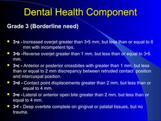 Index of Orthodontic Treatment Need (IOTN) | PPT