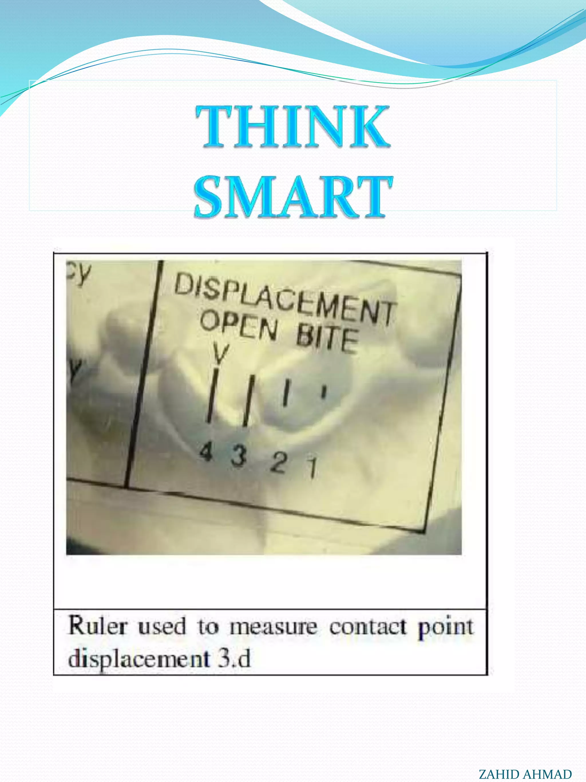 Iotn ruler 2 ore uk | PPTX