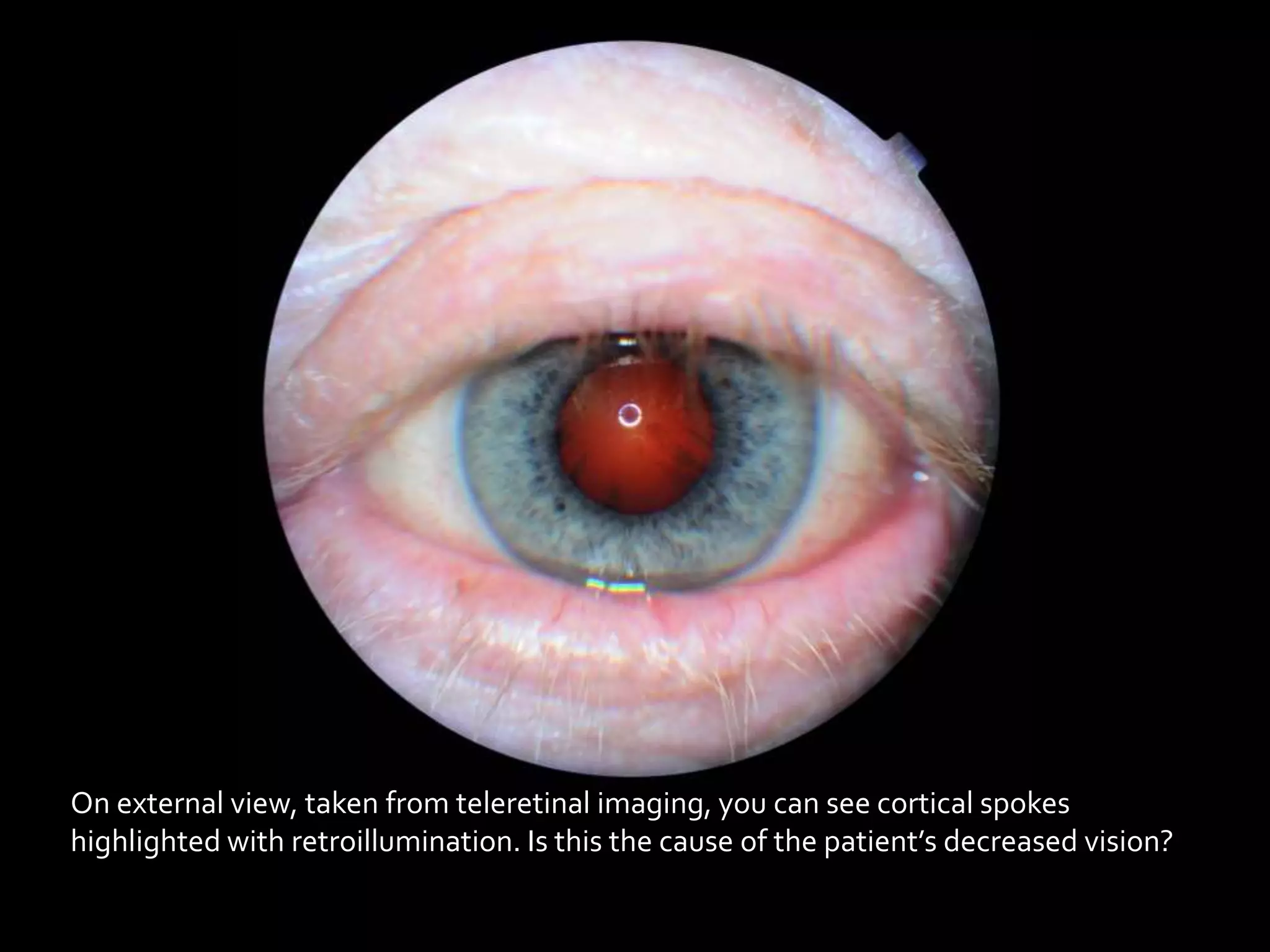 Diabetic Retinopathy: A Clinical Survival Guide | PPTX