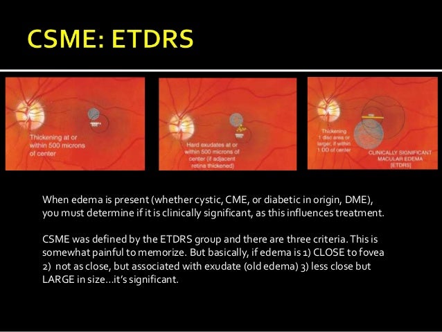 Diabetic Retinopathy: A Clinical Survival Guide