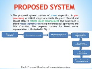 Automatic Blood Vessels Segmentation of Retinal Images | PPTX