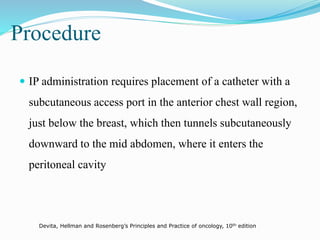 intraperitoneal chemotherapy | PPTX