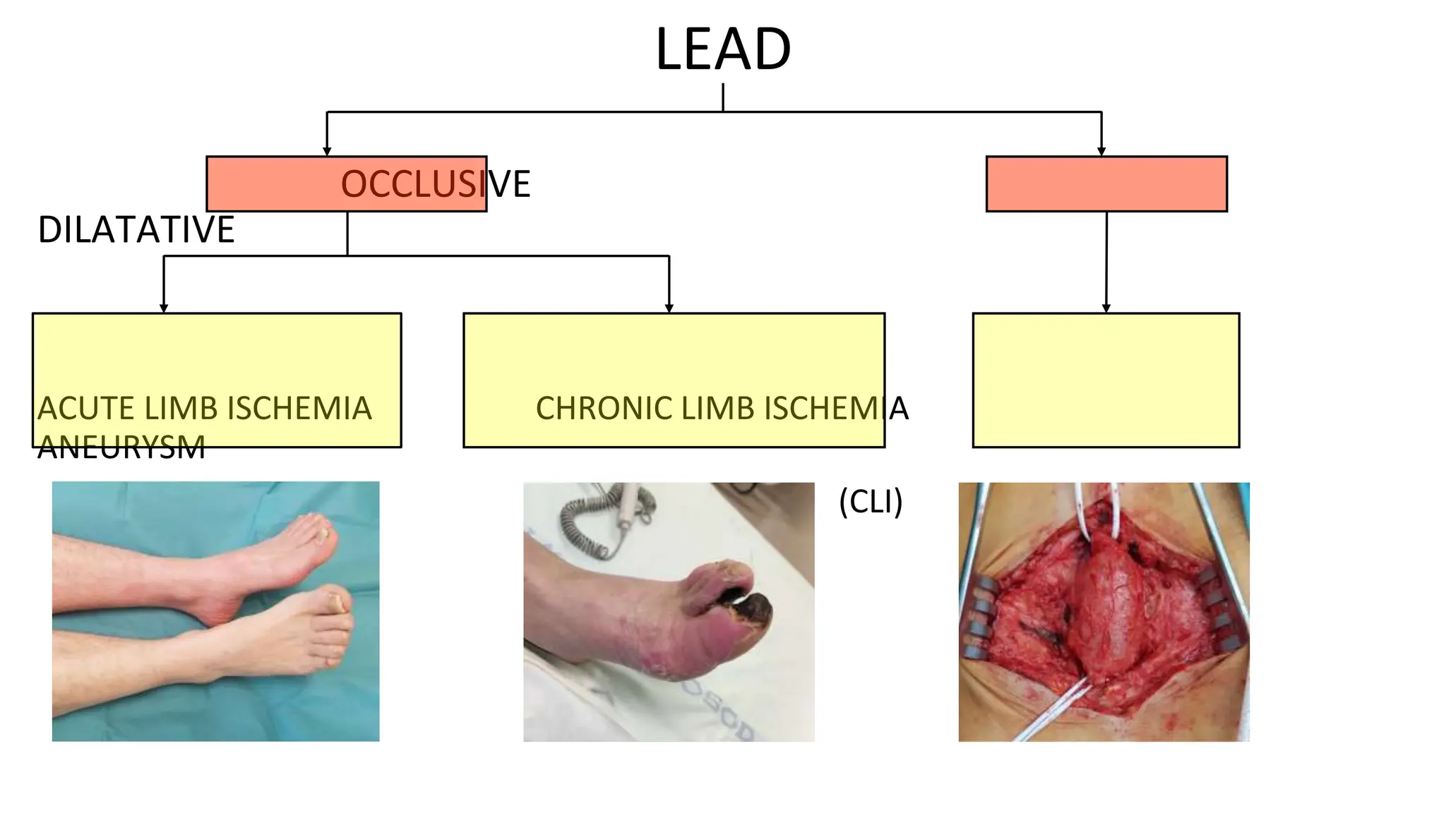 Diagnosis and treatment of lower extremity vascular diseases | PPTX
