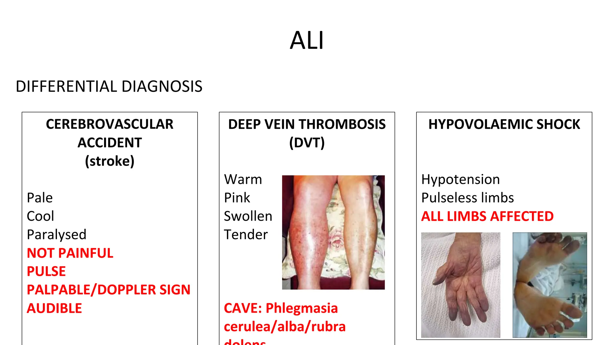 Diagnosis and treatment of lower extremity vascular diseases | PPTX