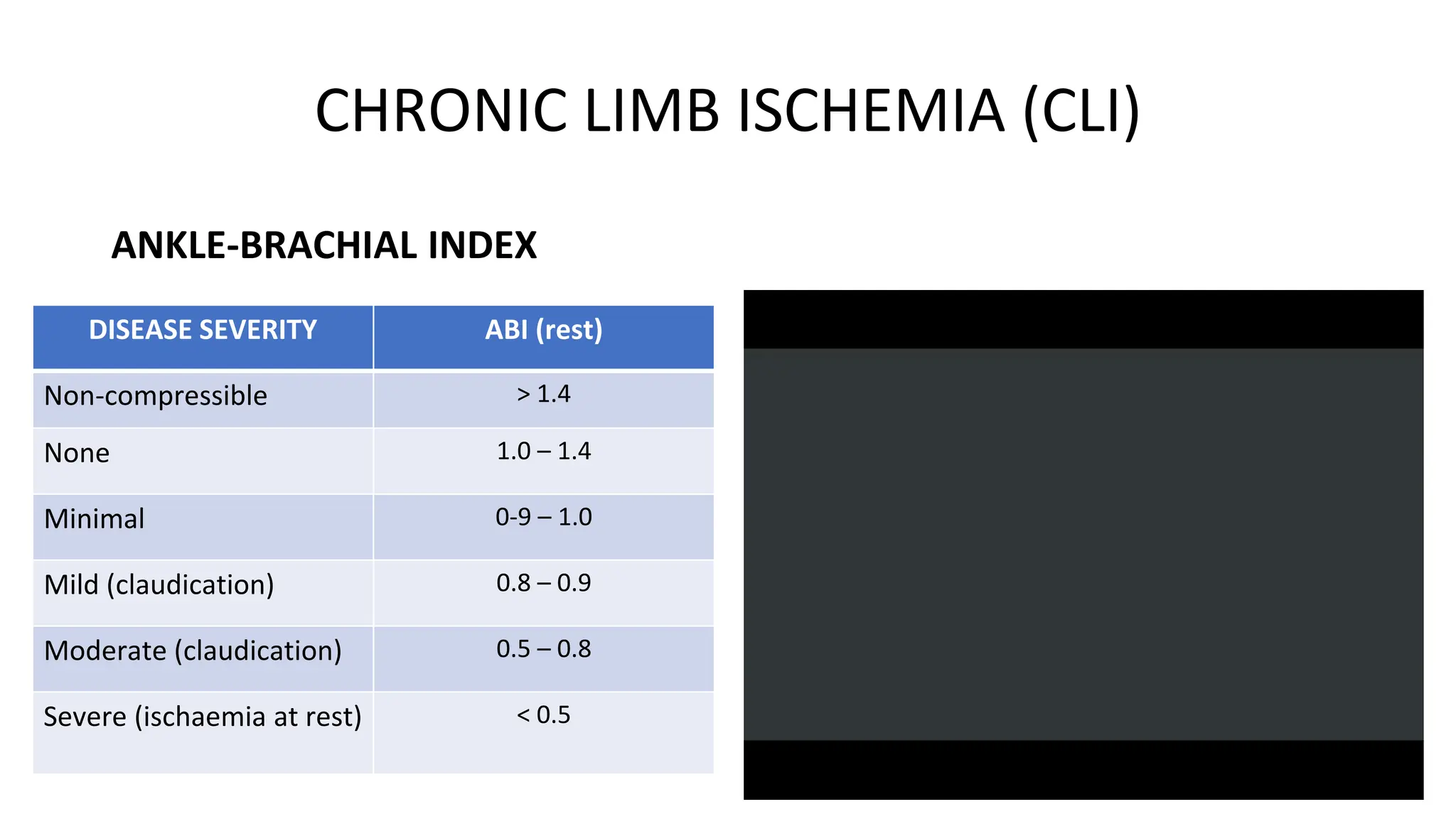 Diagnosis and treatment of lower extremity vascular diseases | PPTX