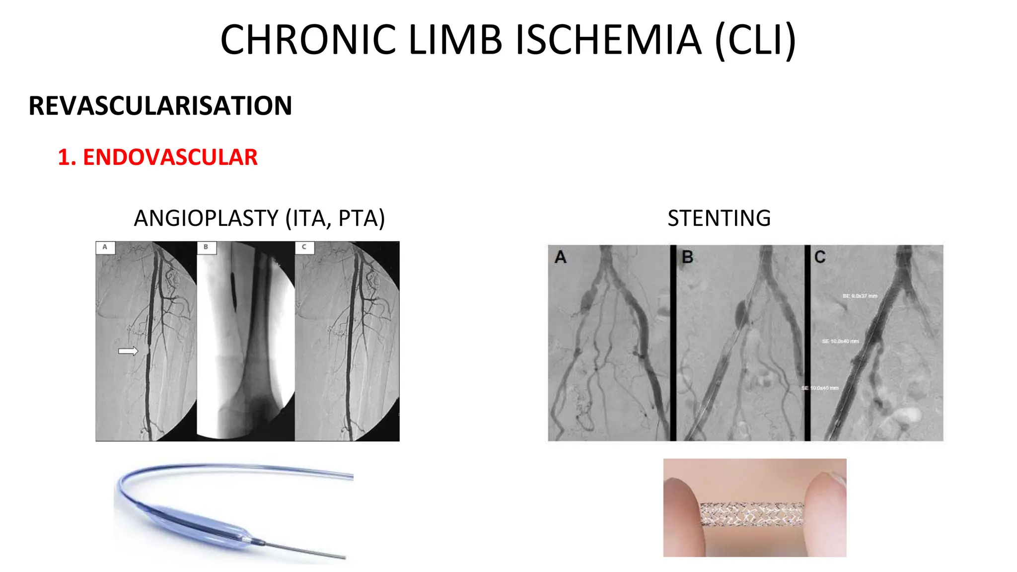 Diagnosis and treatment of lower extremity vascular diseases | PPTX
