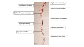 Diagnosis and treatment of lower extremity vascular diseases | PPTX