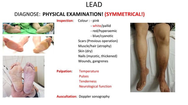 Diagnosis and treatment of lower extremity vascular diseases | PPTX
