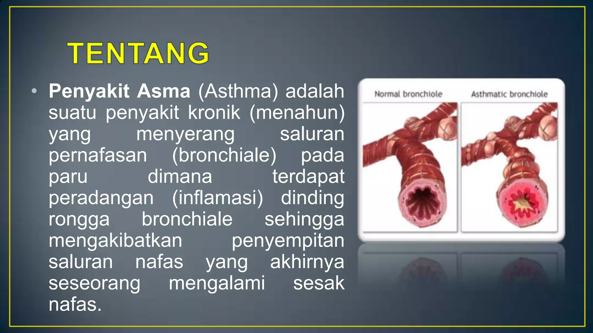 Penyakit pernafasan (Asma) | PPTX