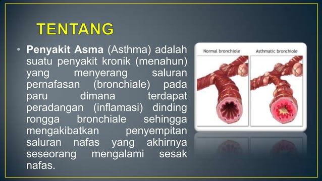 Penyakit pernafasan (Asma) | PPTX