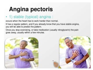 angina pectoris | PPTX