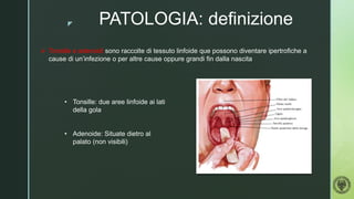 IPERTROFIA ADENOTONSILLARE IN BAMBINO.pptx | Ear, Nose and Throat ...