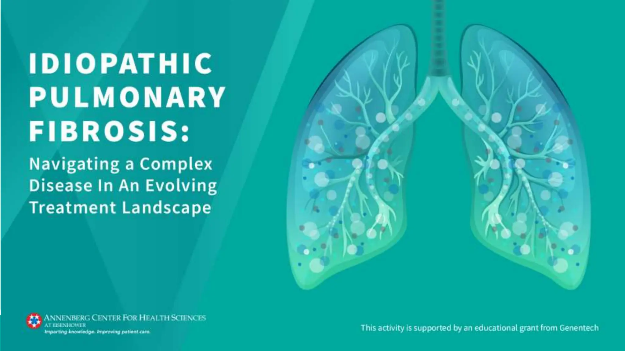 Idiopathic Pulmonary Fibrosis Powerpointpptx
