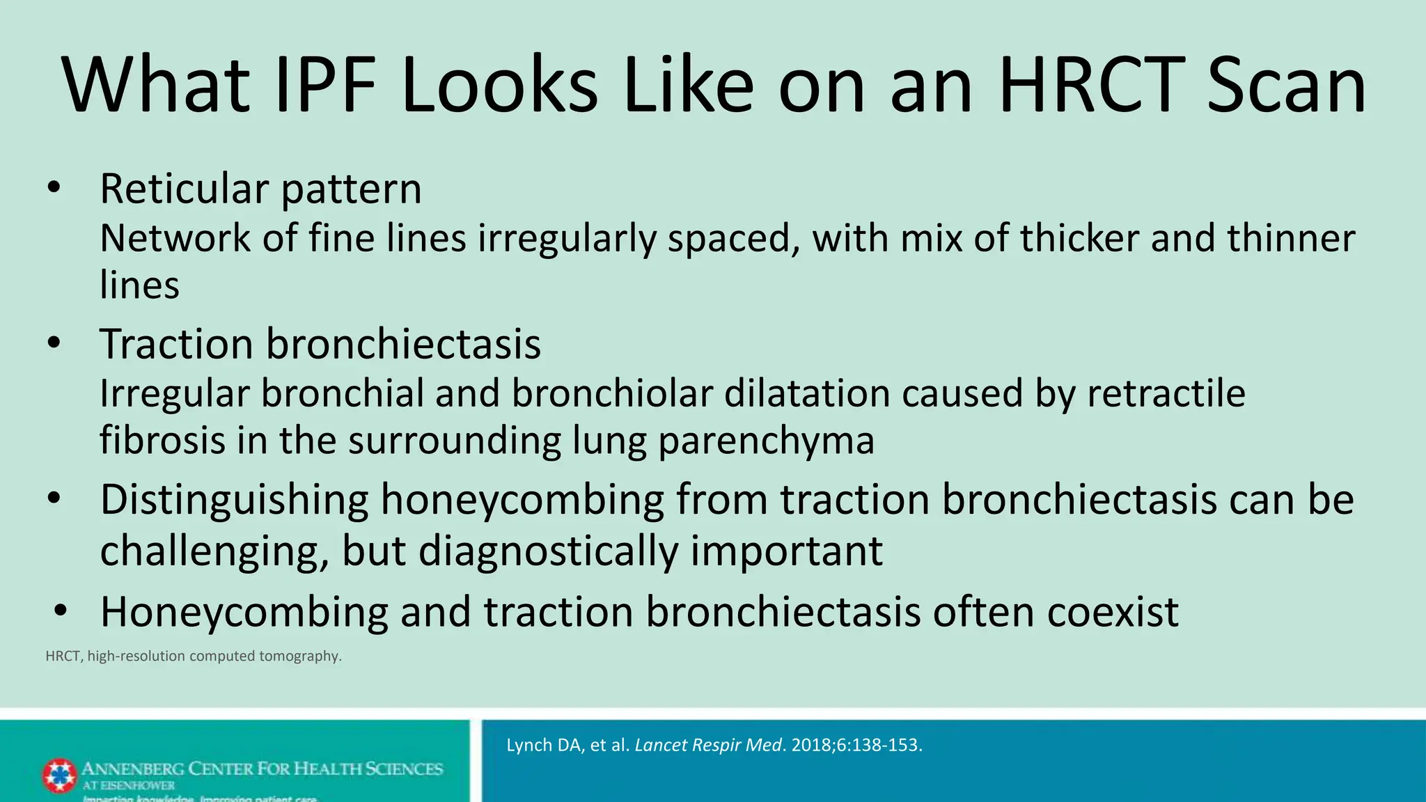 Idiopathic Pulmonary Fibrosis powerpoint.pptx
