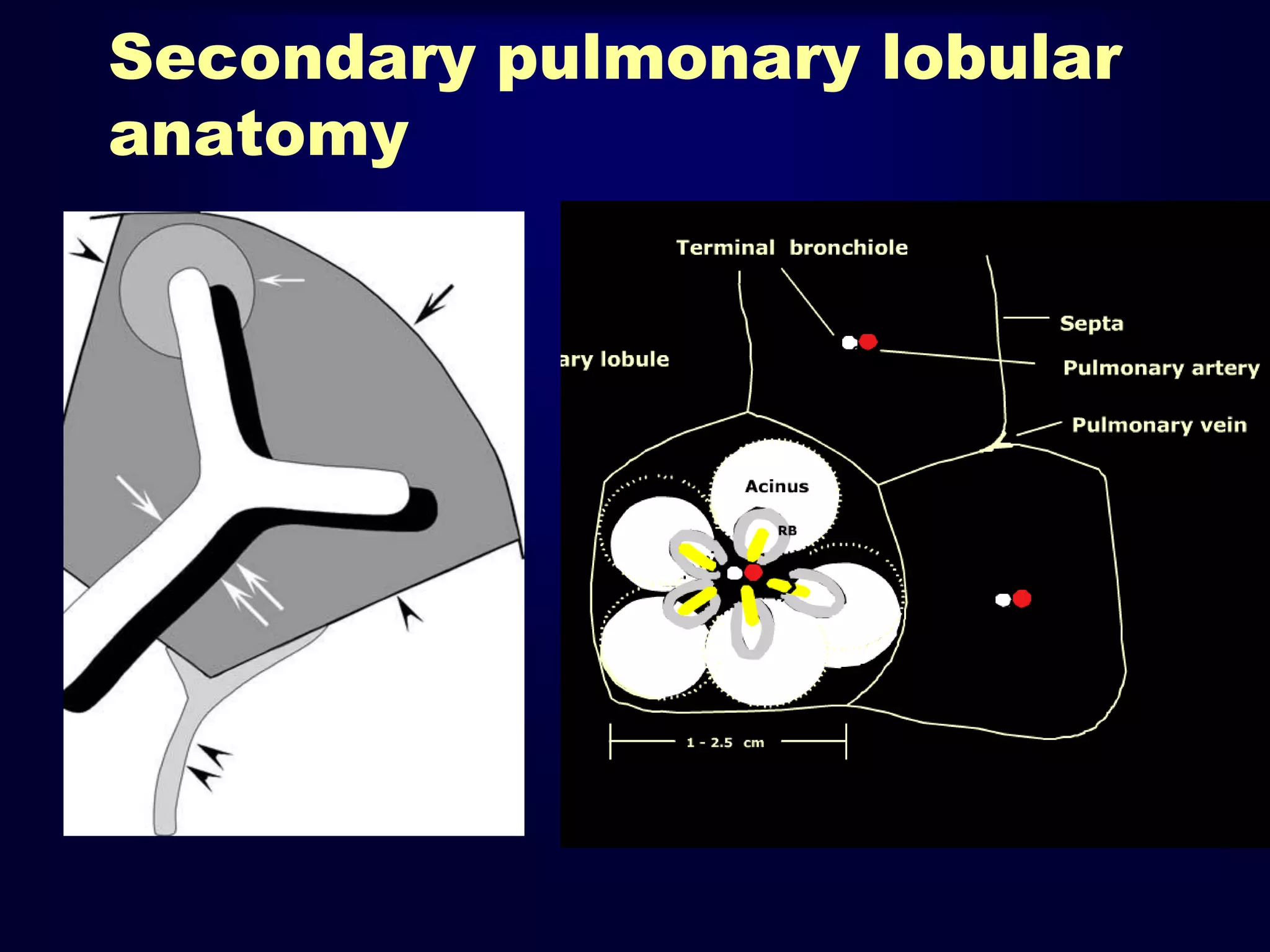 Ipf or non ipf interstitial lung diseases | PPT