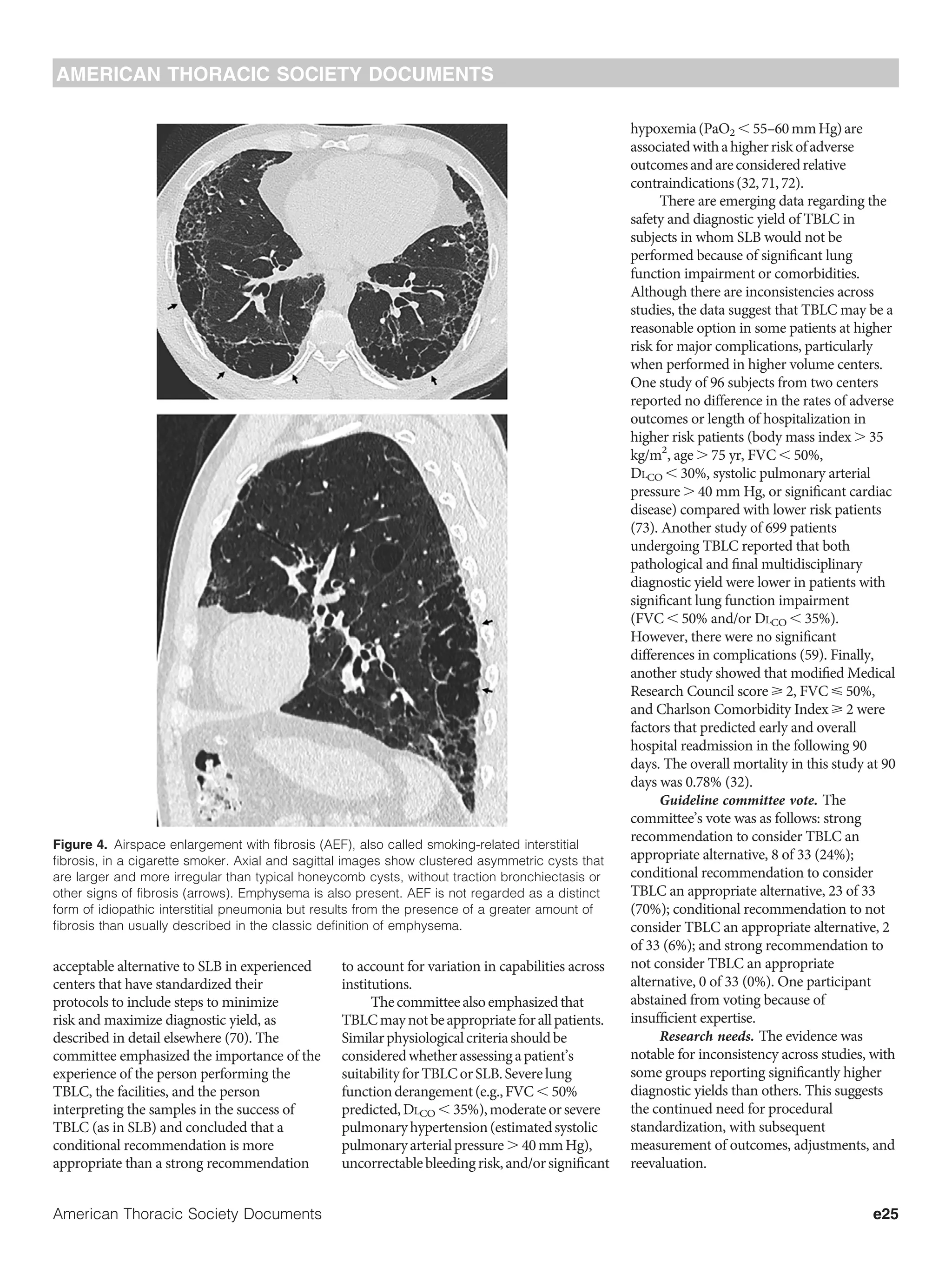 IPF & Progressive Pulmonary Fibrosis in Adult ATS ERS JRS Clinical ...