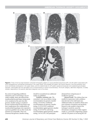 IPF & Progressive Pulmonary Fibrosis in Adult ATS ERS JRS Clinical Practive Guideline 2022.pdf