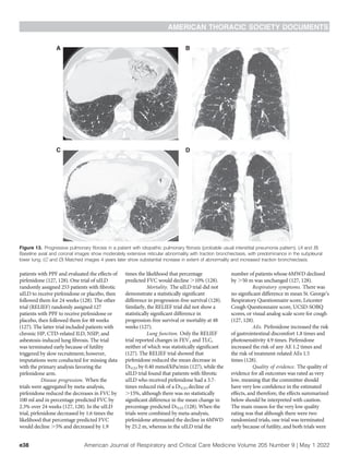IPF & Progressive Pulmonary Fibrosis in Adult ATS ERS JRS Clinical ...
