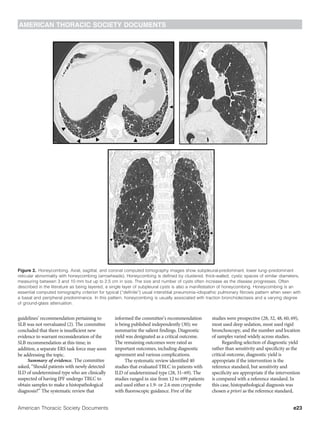 IPF & Progressive Pulmonary Fibrosis in Adult ATS ERS JRS Clinical ...