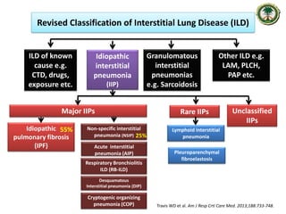 An update on the management of Idiopathic Pulmonary Fibrosis (IPF) | PPT