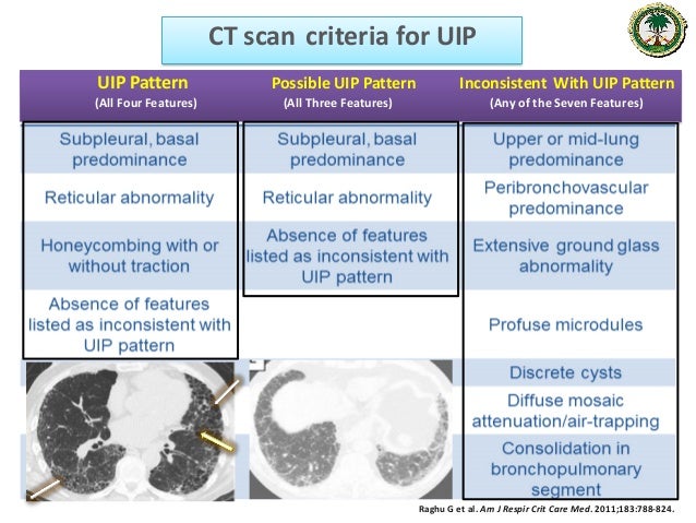 An update on the management of Idiopathic Pulmonary Fibrosis (IPF)