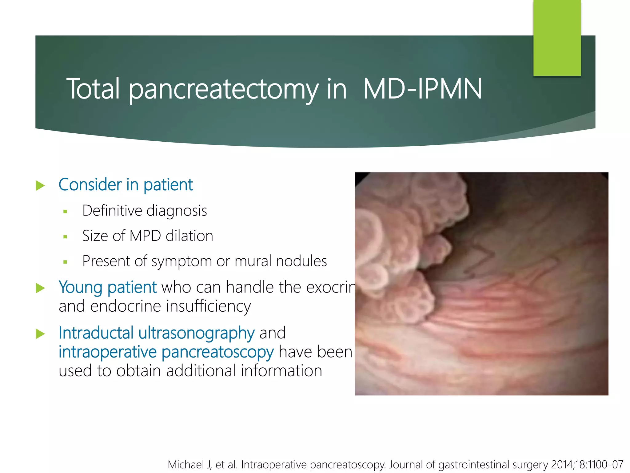 Management of IPMN | PPTX