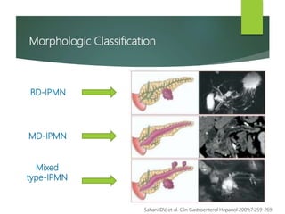 Management of IPMN | PPT
