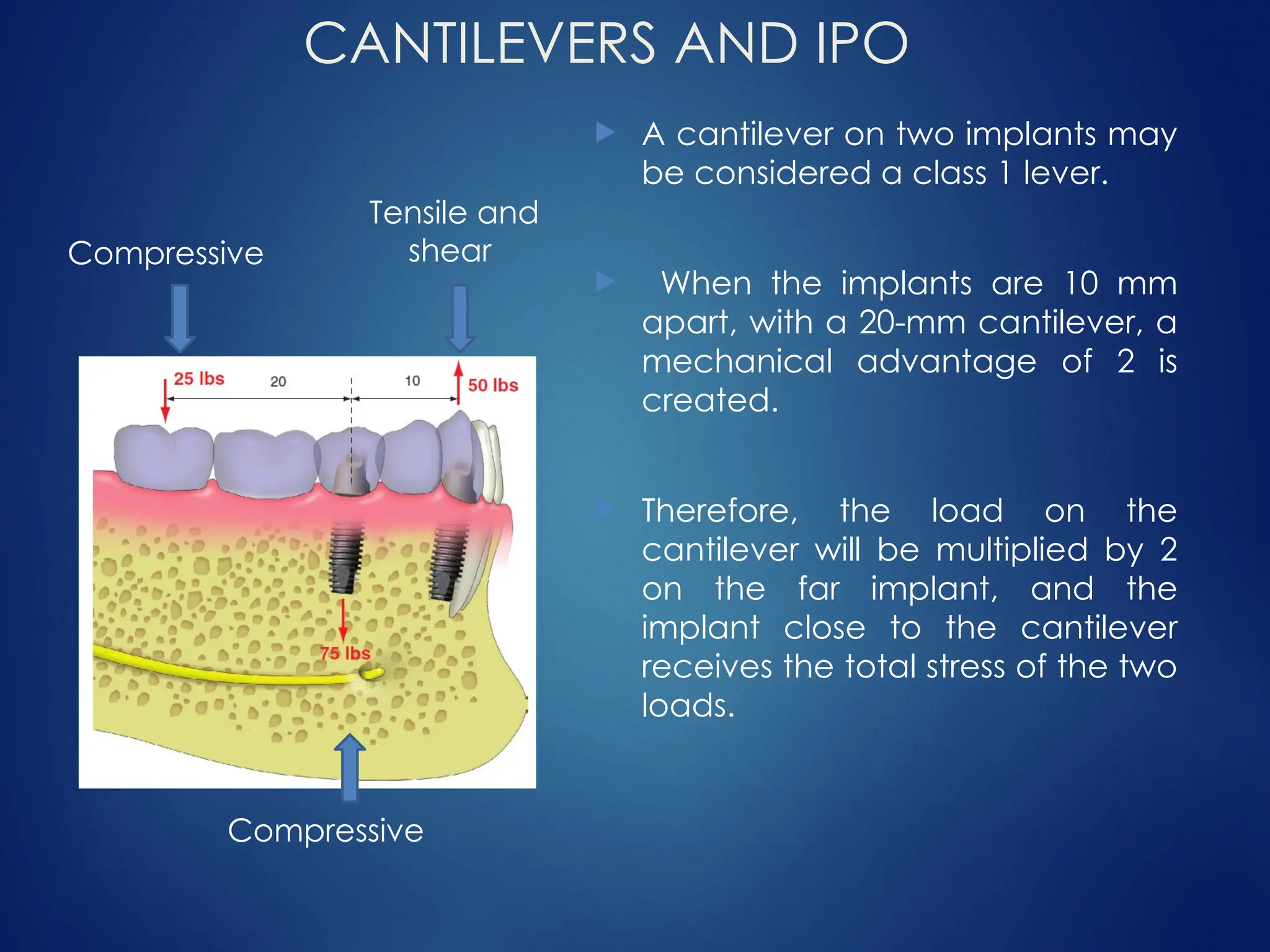 implant protective occlusion in prosthodontics | PPTX