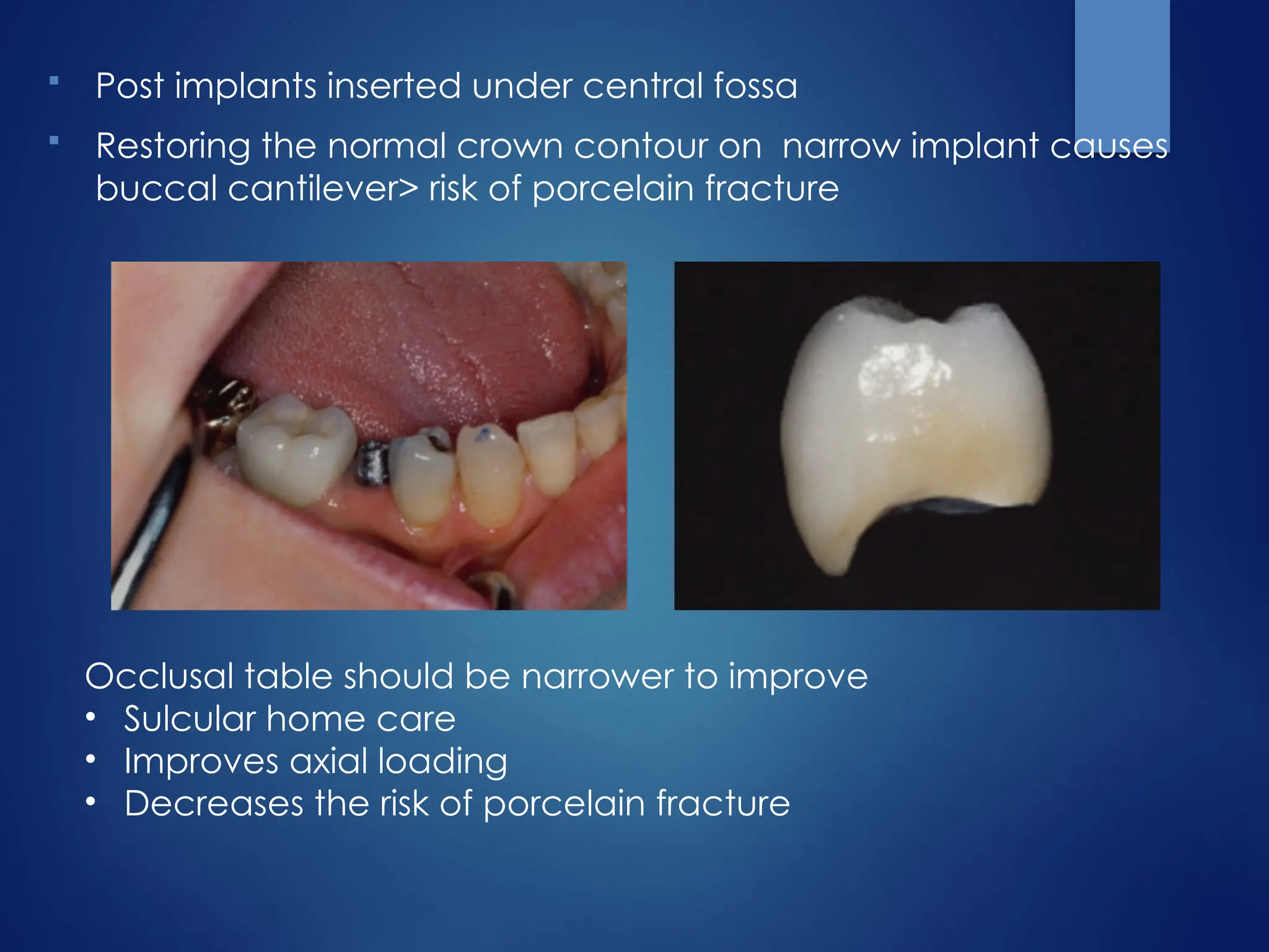 implant protective occlusion in prosthodontics | PPTX