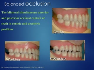 implant protective occlusion in prosthodontics | PPTX