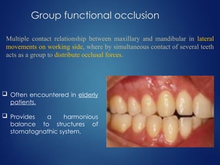 implant protective occlusion in prosthodontics | PPTX