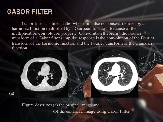 Cancer Cell Detection Using Digital Image Processing