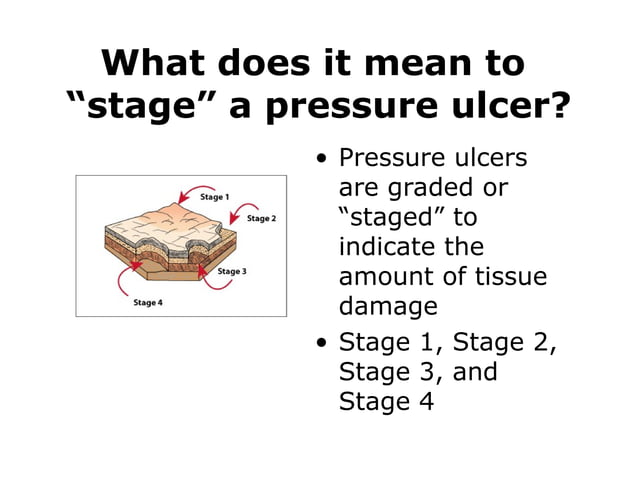 How to Identify and Prevent Pressure Ulcers | PPT