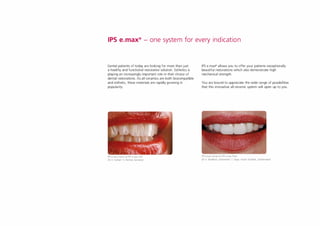 Ips e max_system_dentist | PPT