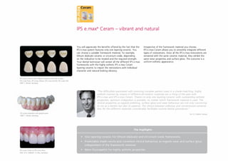 Ips e max_system_dentist | PDF