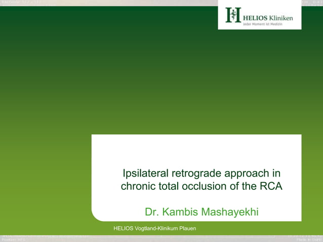 14:25 Mashayekhi - Ipsilateral approach | PPT