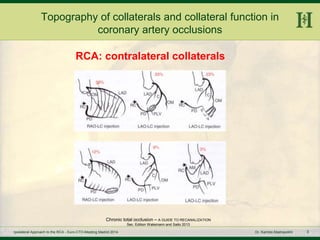 14:25 Mashayekhi - Ipsilateral approach | PPT