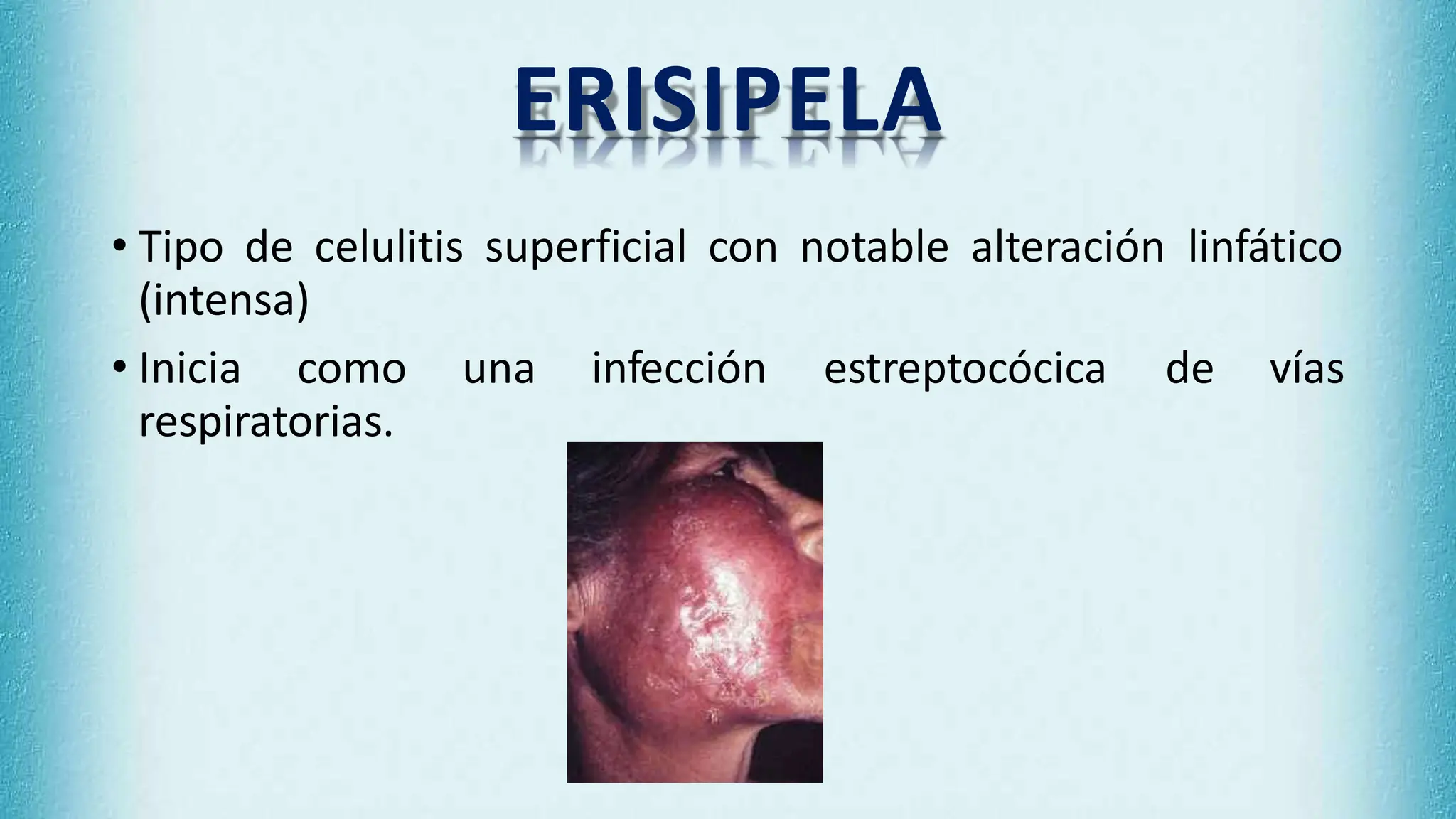 INFECCION DE PIEL Y PARTES BLANDAS BASICO | PPT