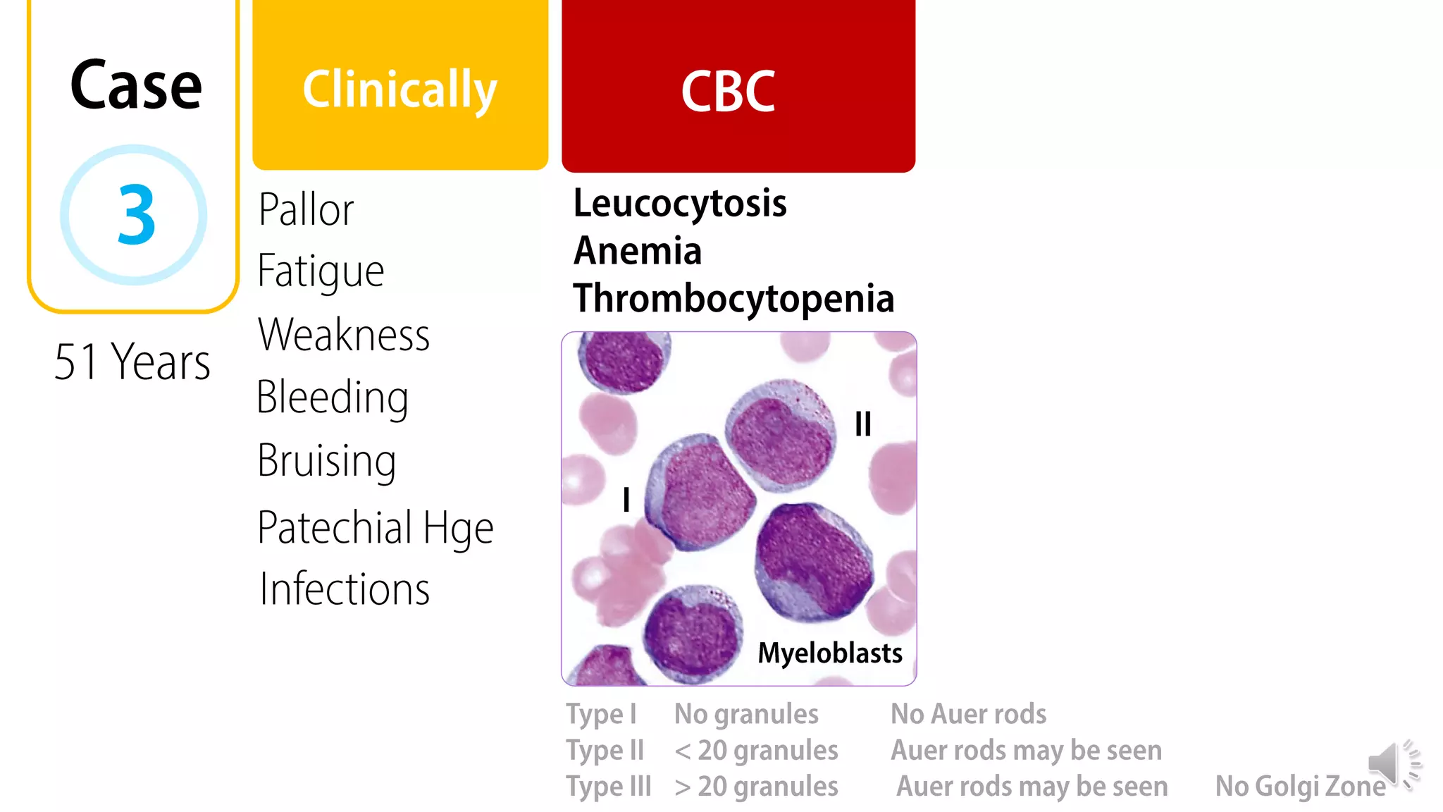 Immunophenotyping of acute leukemia - part 3 | PDF