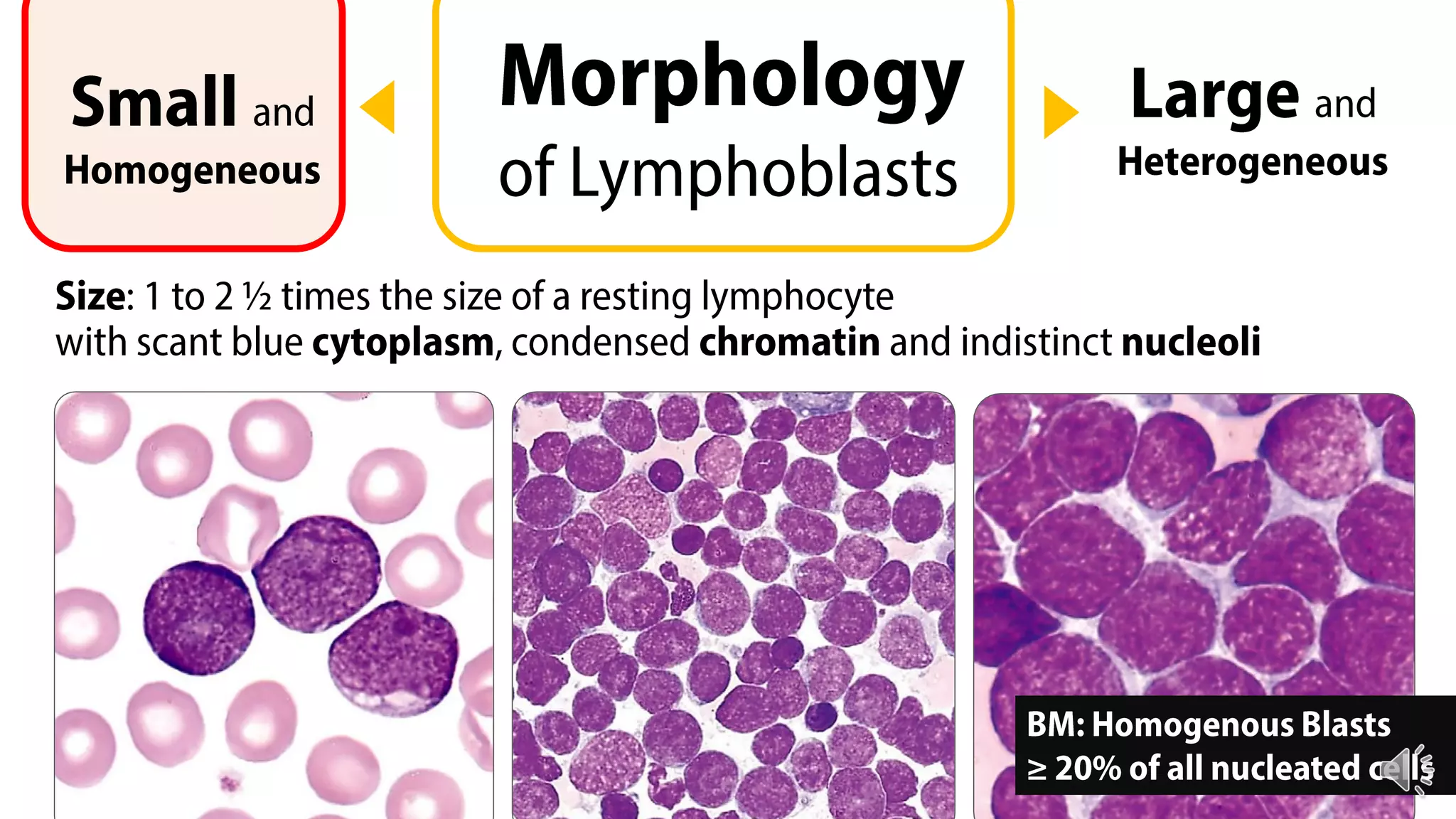 Immunophenotyping of acute leukemia - part 3 | PDF