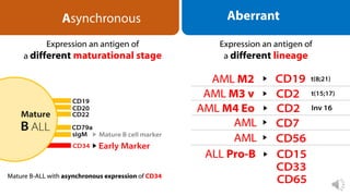 Immunophenotyping of acute leukemia - part 4 | PDF